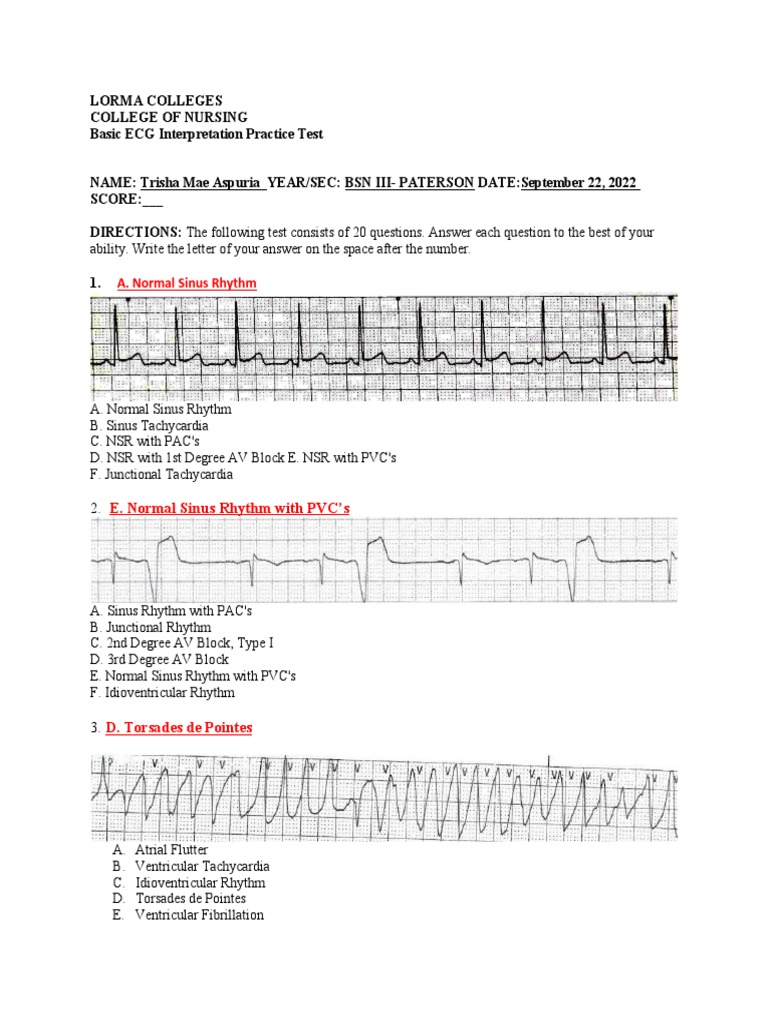 Basic ECG Interpretation Test | PDF | Cardiovascular System | Clinical ...