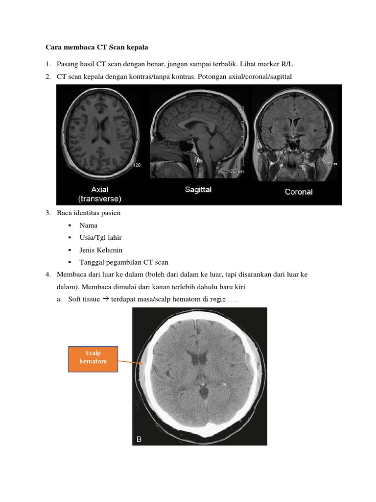 Cara Baca CT Scan Kepala | PDF