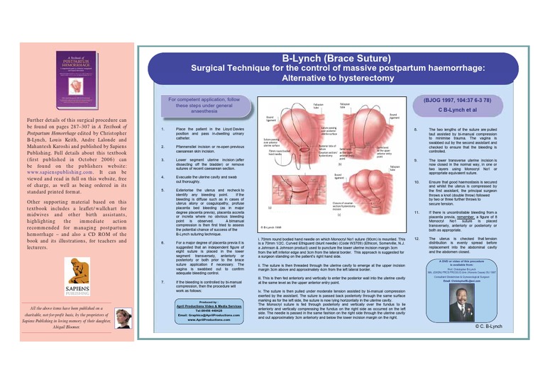 PPH Poster | PDF | Uterus | Surgical Suture