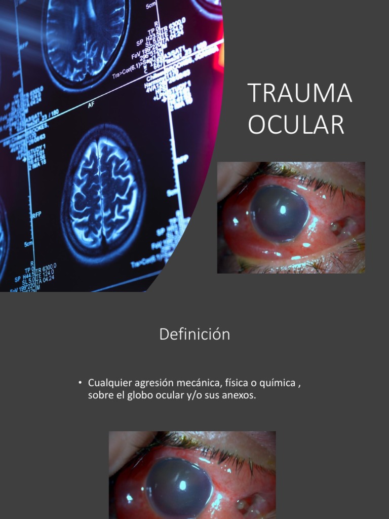 Semana 2.trauma Ocular 1 | PDF | Lesión | Ojo humano