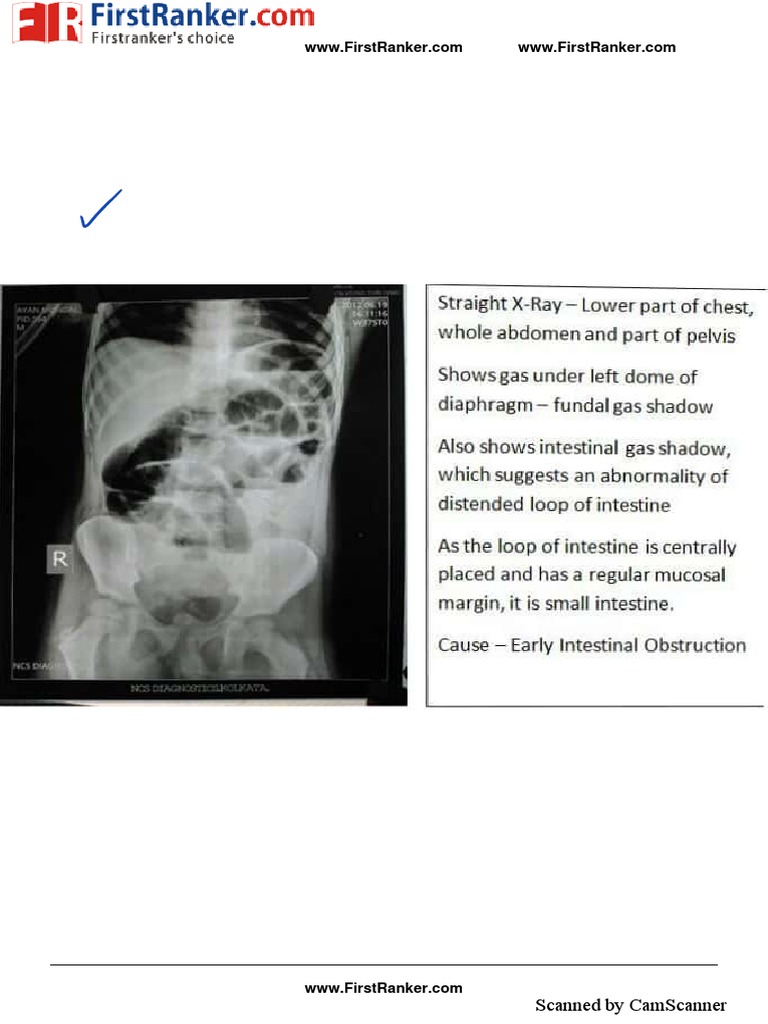 Surgery X Rays | PDF | Pediatrics | Neoplasms