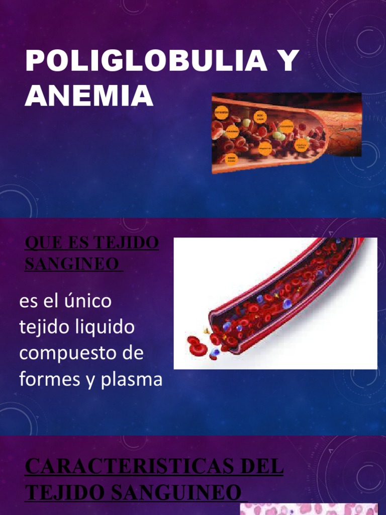 Poliglobulia y Anemia. | PDF