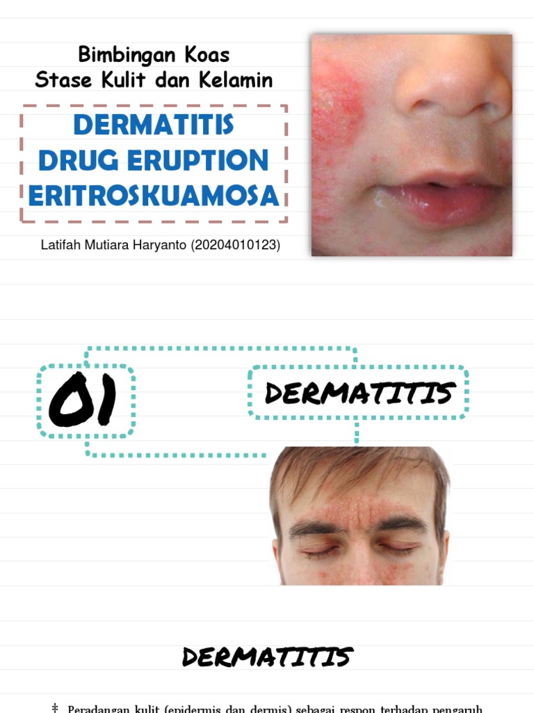 Day 3 - Dermatitis Dan Drug Eruption | PDF