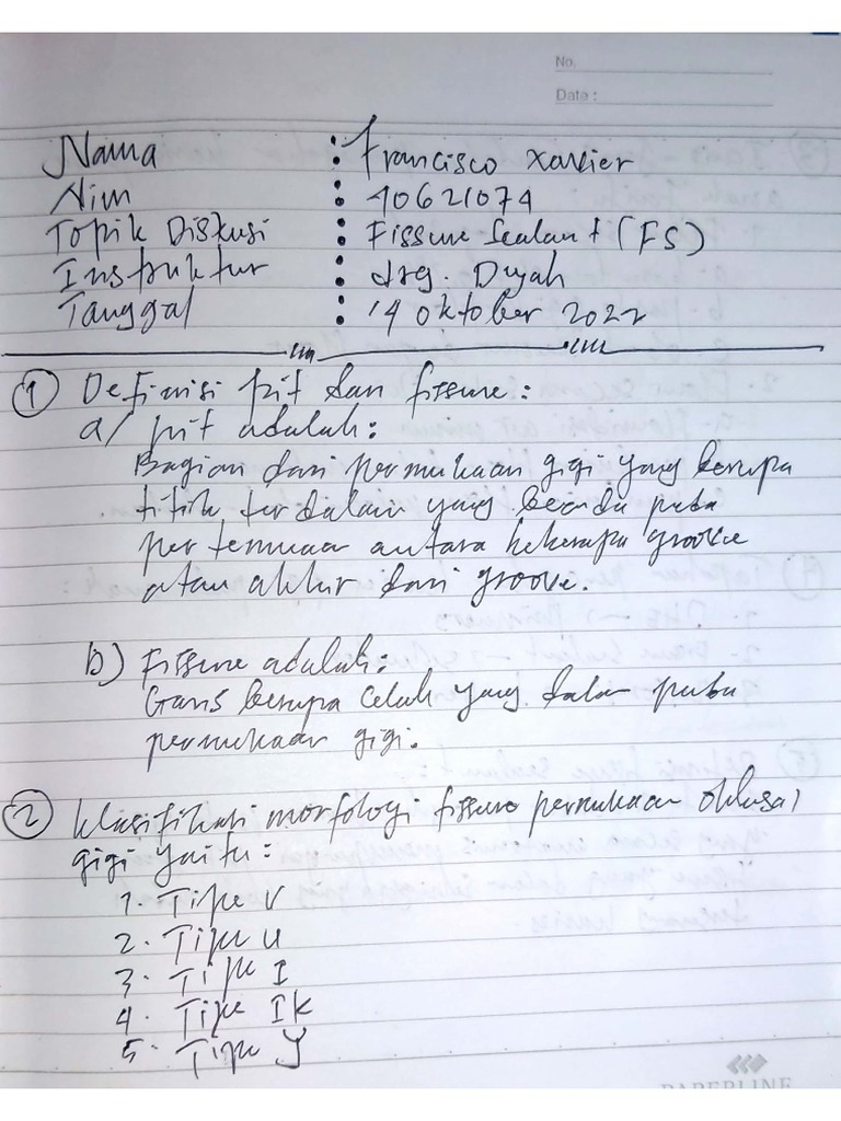 Francisco Xavier Resume FS (FISSURE SEALANT) | PDF