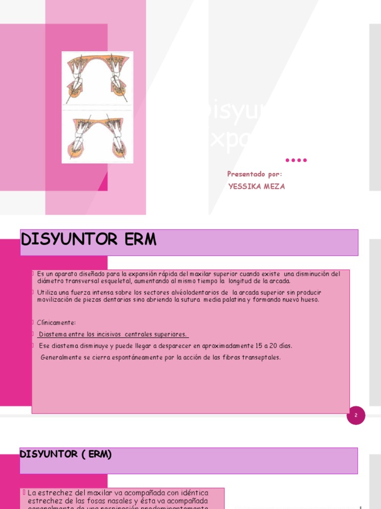 expansion-vs-disyuncion-pdf