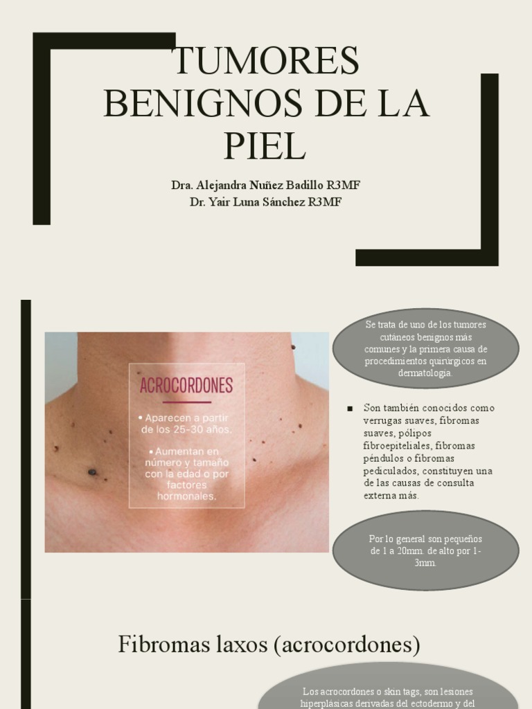 Expo Derma | PDF | Cáncer | Piel