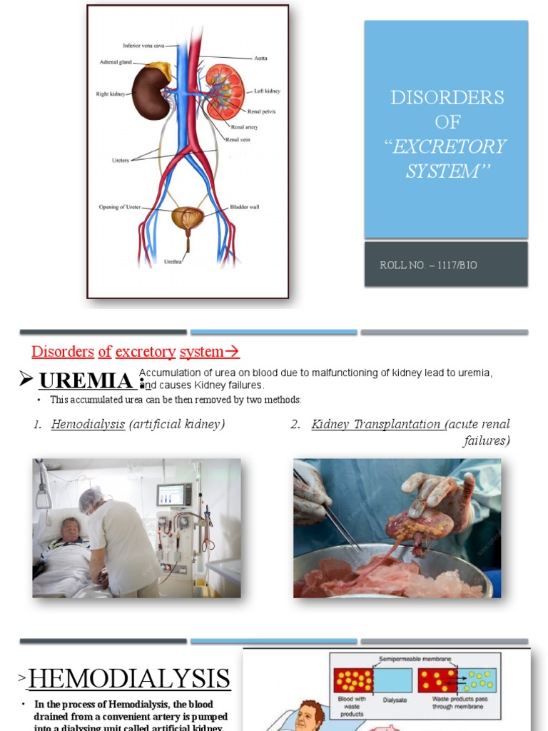 Disorders of Excretory Systems | PDF | Nephrology | Medical Specialties