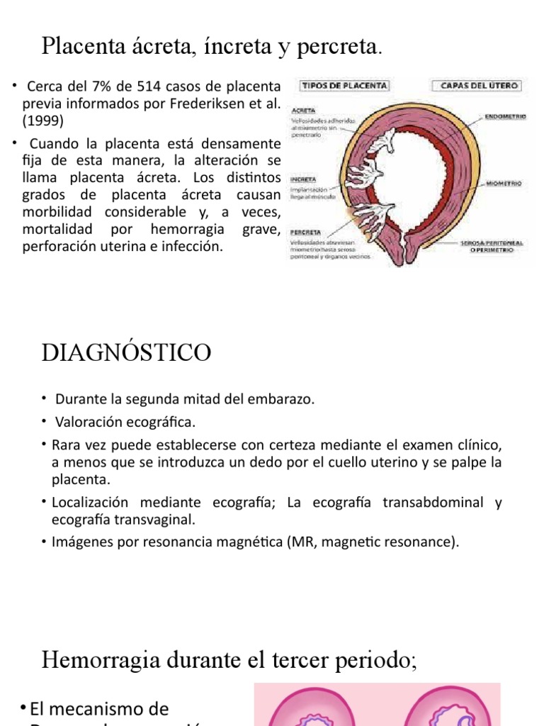 Placenta Ácreta, Íncreta y Percreta | PDF