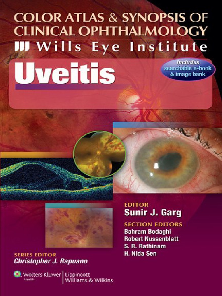 Color Atlas & Synopsis of Clinical Ophthalmology - Wills Eye Institute ...