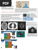 Pitch y TC Helicoidal | PDF | Ct Scan