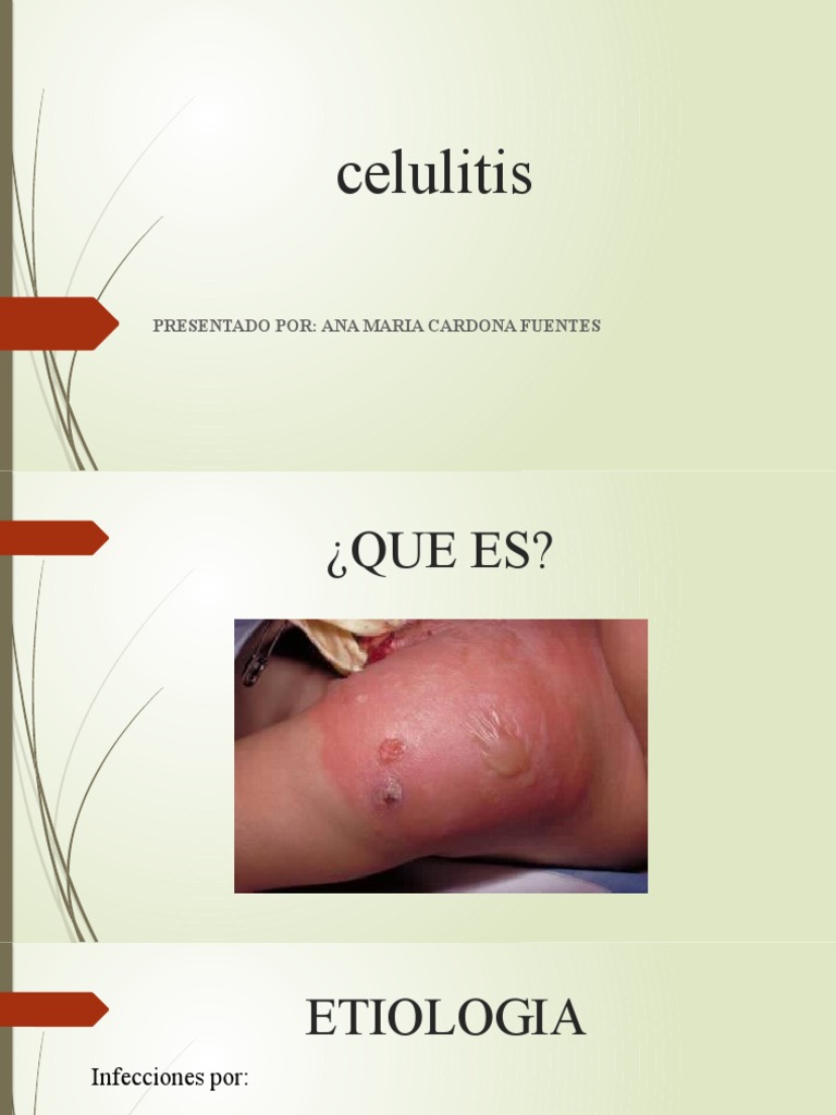 Celulitis | PDF | Epidemiología | Ciencias de la Salud