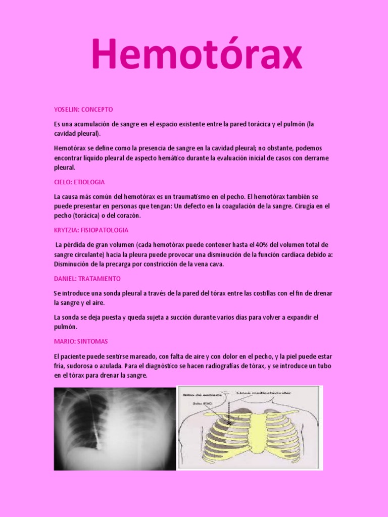 Hemotorax | PDF