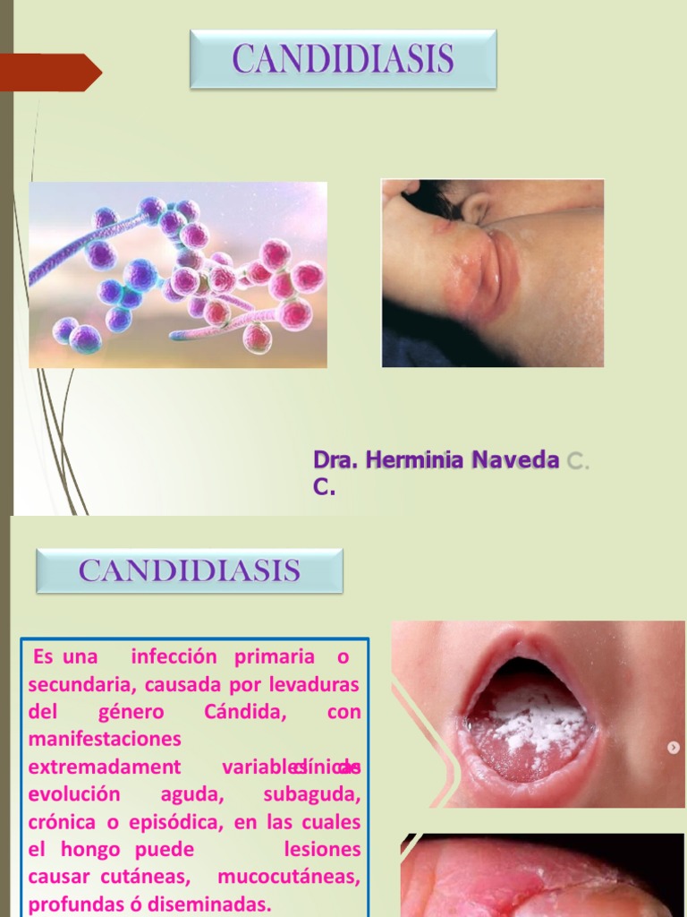 Candidiasis | PDF | Candidiasis | Enfermedades y trastornos