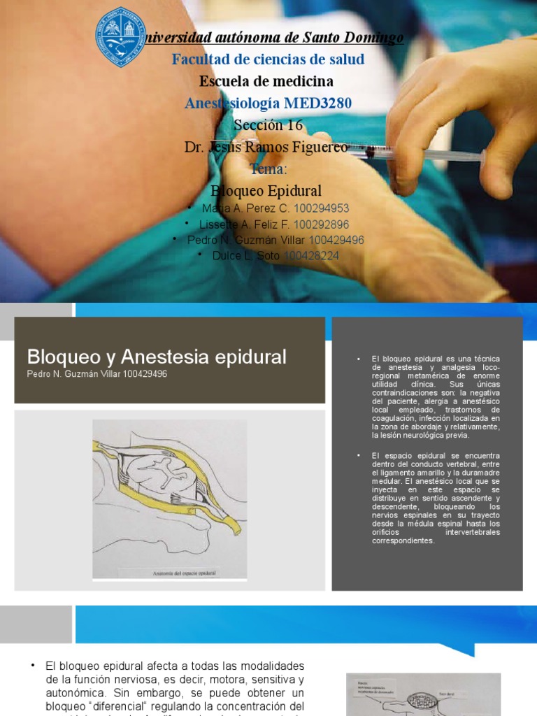 Anatomía y Técnica del Bloqueo Epidural | PDF | Abdomen | Médula espinal