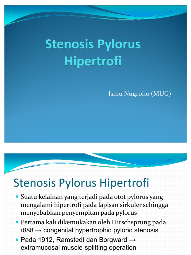 Stenosis Pylorus Hipertrofi | PDF