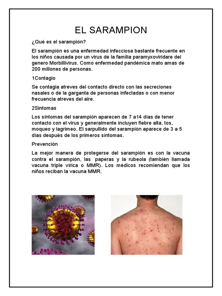 El Sarampion | PDF