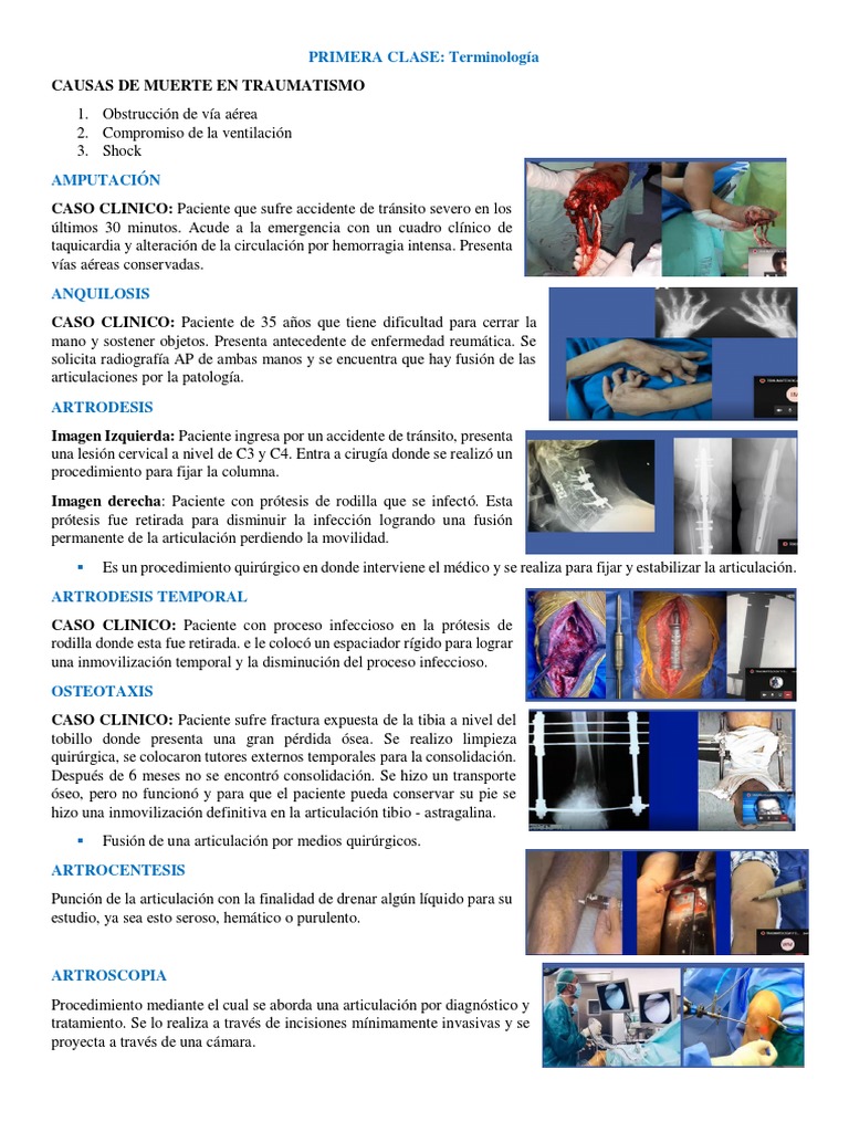 Traumato Pack 2 | PDF | Hueso | Rodilla