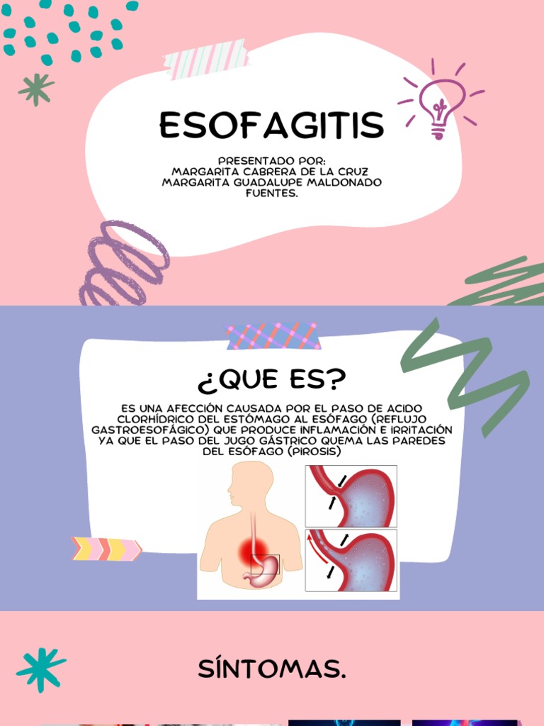 Síntomas y Tratamiento de la Esofagitis | PDF | Especialidades Medicas ...