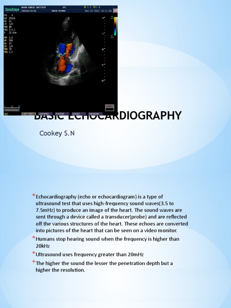 Echocardiography Basics Guide | PDF | Echocardiography | Medical Ultrasound