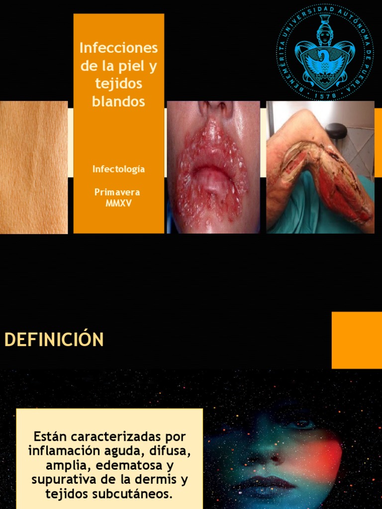 Infecciones Bacterianas de Piel y Tejidos Blandos | PDF | Penicilina ...