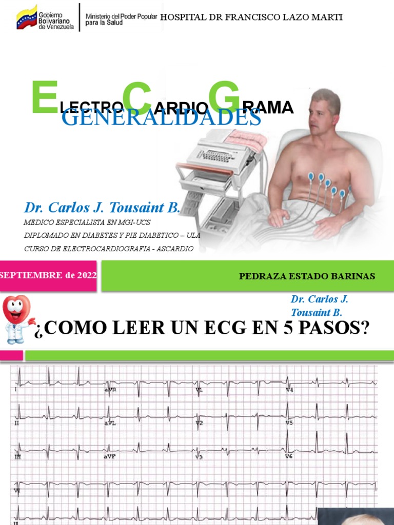 ECG. Dr. Carlos Tousaint R-FEOS | PDF | Electrocardiografia | Electrofisiologia