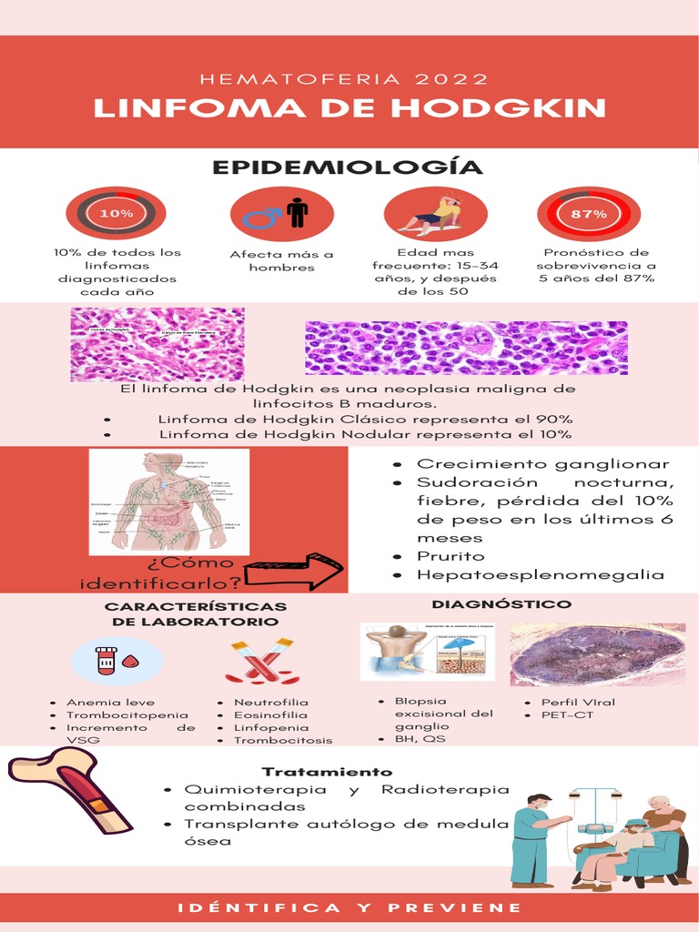 Linfomas de Hodgkin | PDF