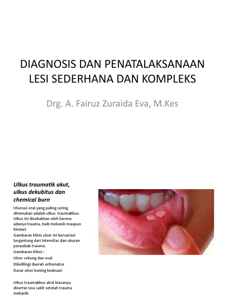 Baru Mulai Susun Diagnosis Dan Penatalaksanaan Lesi Sederhana Dan Kompleks | PDF