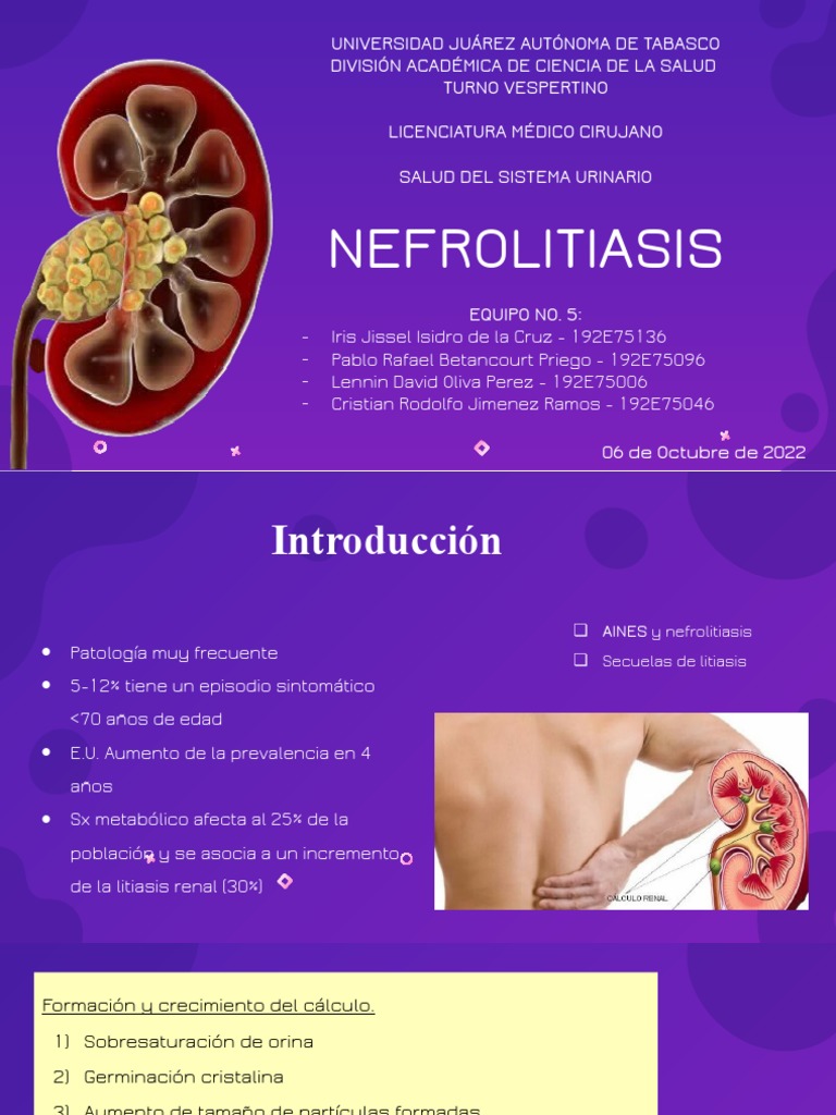 Nefrolitiasis | PDF | Medicina CLINICA | Especialidades Medicas