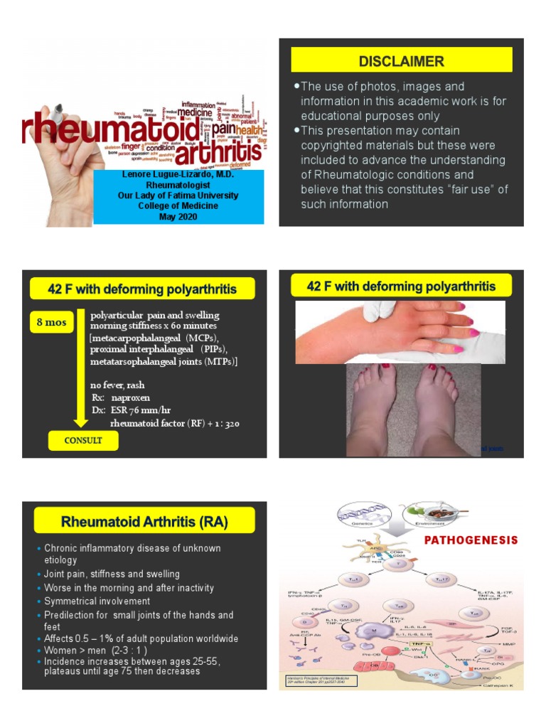 5.0 Rheumatoid Arthritis | PDF | Rheumatoid Arthritis | Arthritis