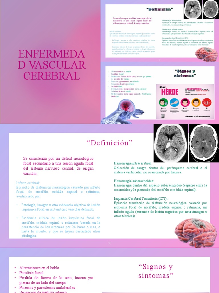 Enfermedad Vascular Cerebral | PDF