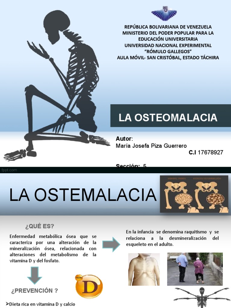 La Osteomalacia. | PDF | Vitamina D | Hueso
