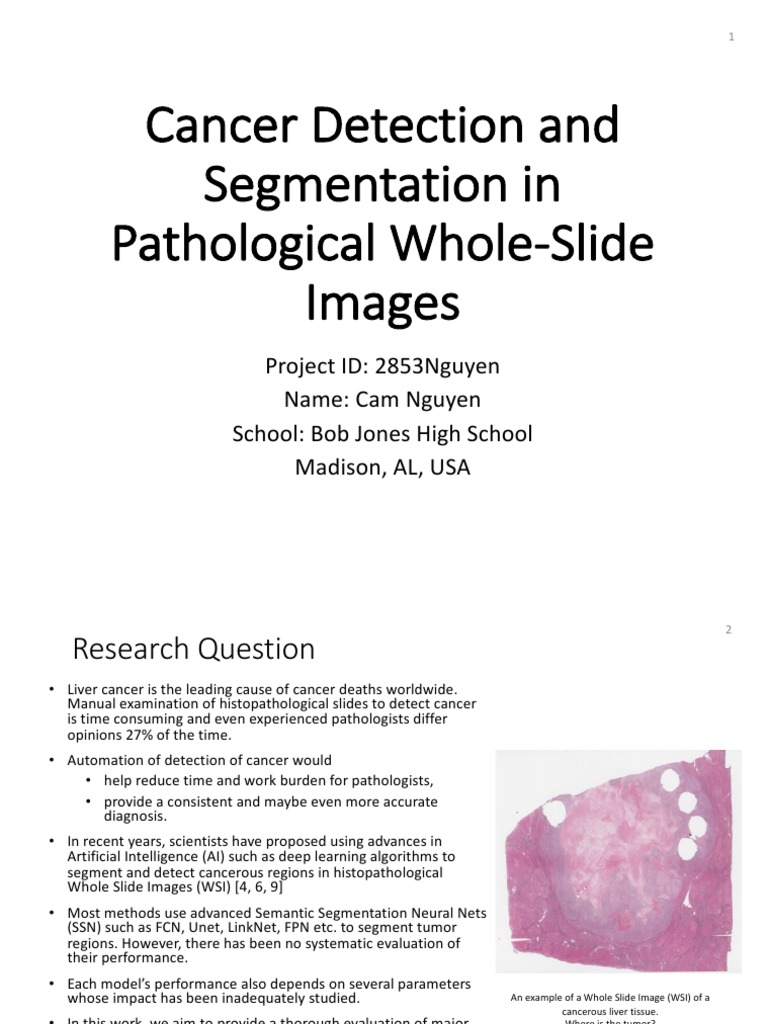 Cancer Detection And Segmentation Project Ppt Compressed Pdf Image
