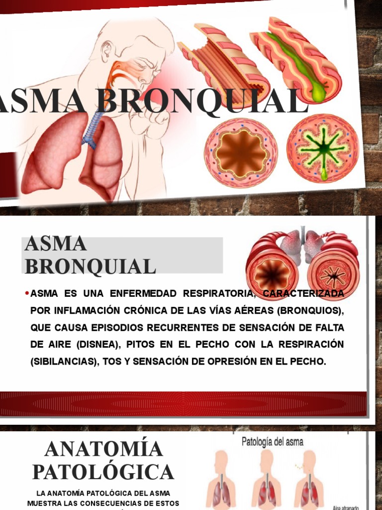 Causas y Tratamiento del Asma Bronquial | PDF | Asma | Alergia