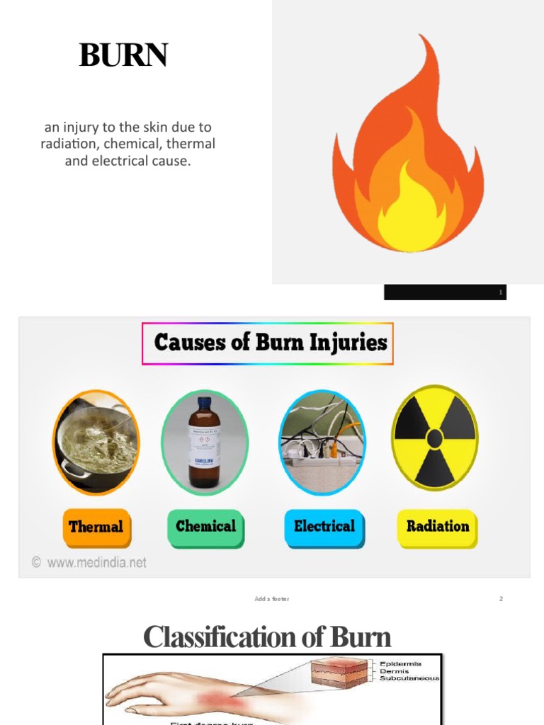 Burn | PDF | Burn | Clinical Medicine