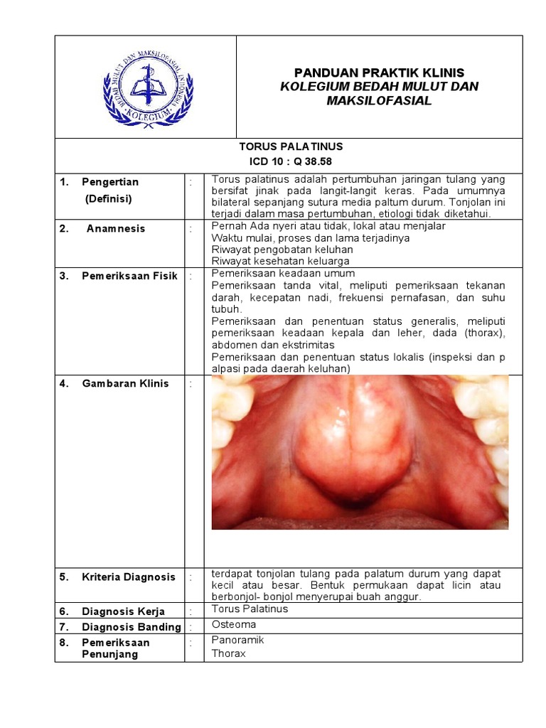 PPK Gigi - Torus Palatinus | PDF