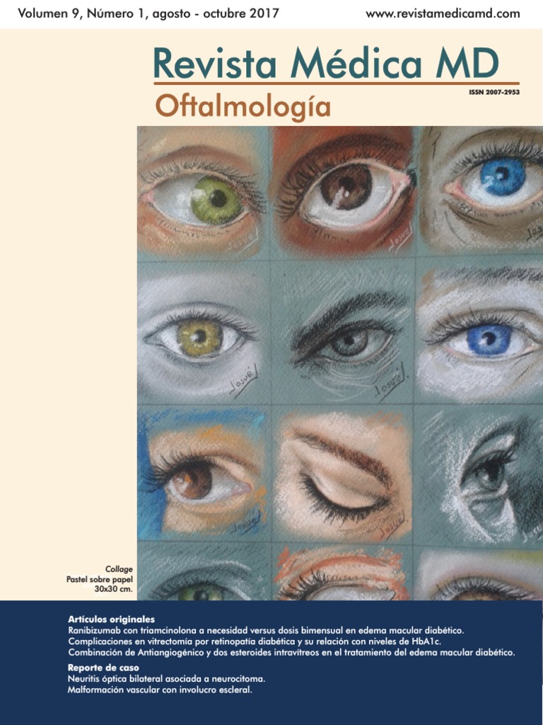 Oftalmologia Rev Med MD Vol 9 Num 1 Web | PDF | Oftalmología | Catarata