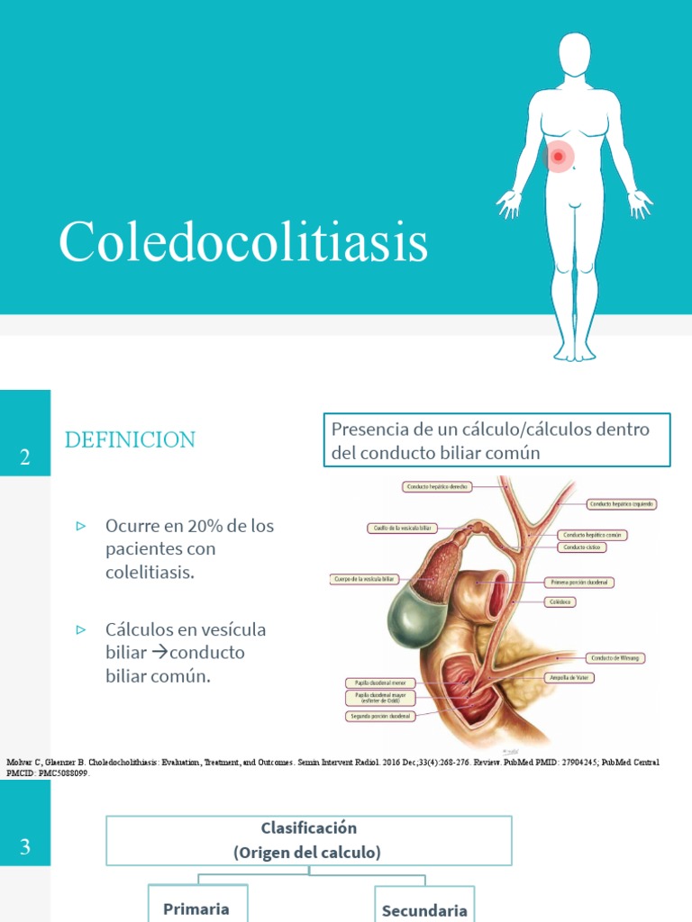 Coledocolitiasis | PDF | Sistema exocrino | Ciencias de la Salud