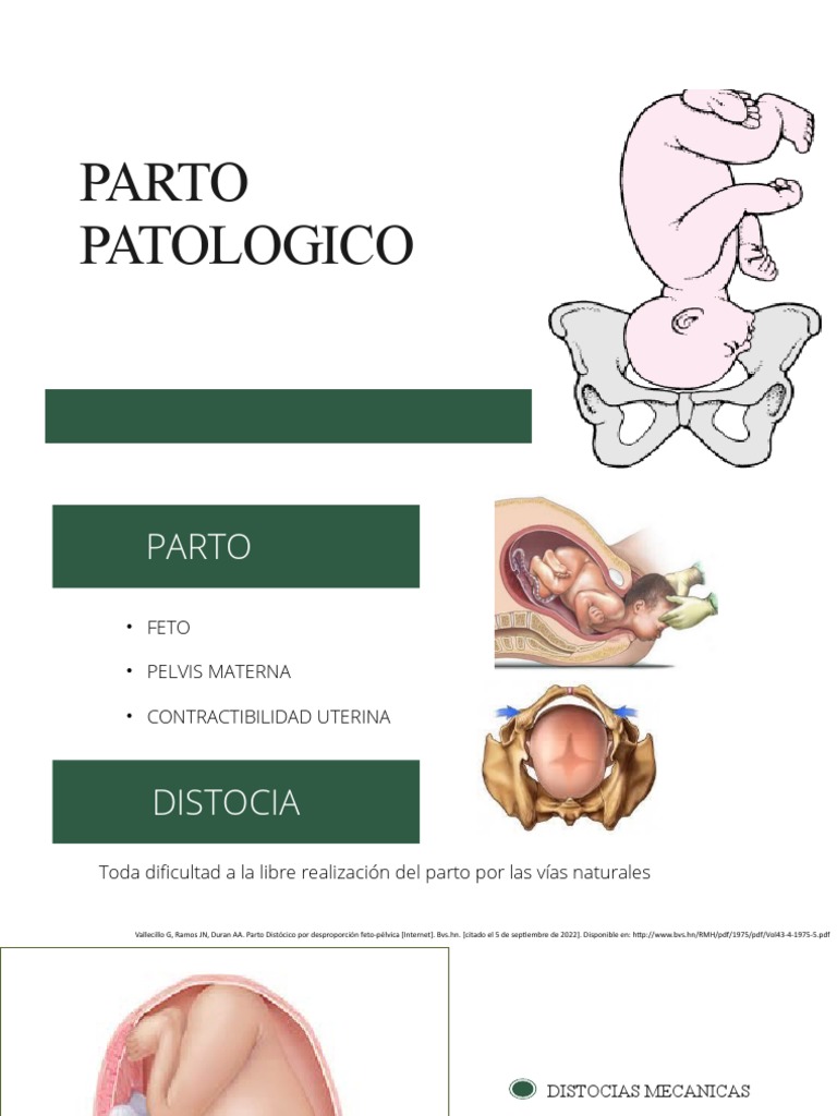 Seminario Distocias Del Parto | Descargar gratis PDF | Especialidades ...