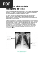 Proyecciones Rx de Tórax: PA y AP | PDF | Tórax (anatomía humana ...