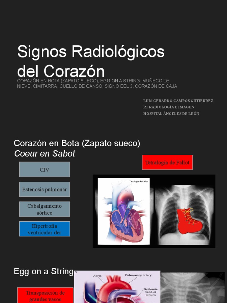 Signos Radiológicos Del Corazón | PDF | Corazón | Tórax (anatomía humana)