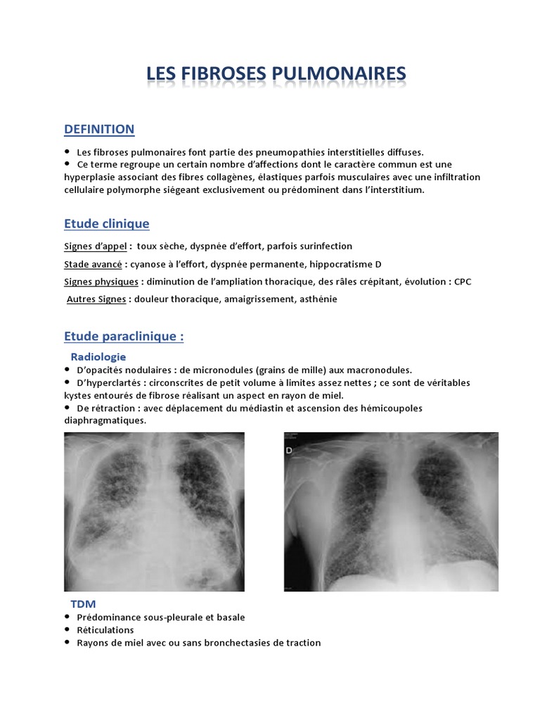 Fibrose Et PID | PDF | Poumon | Spécialités médicales
