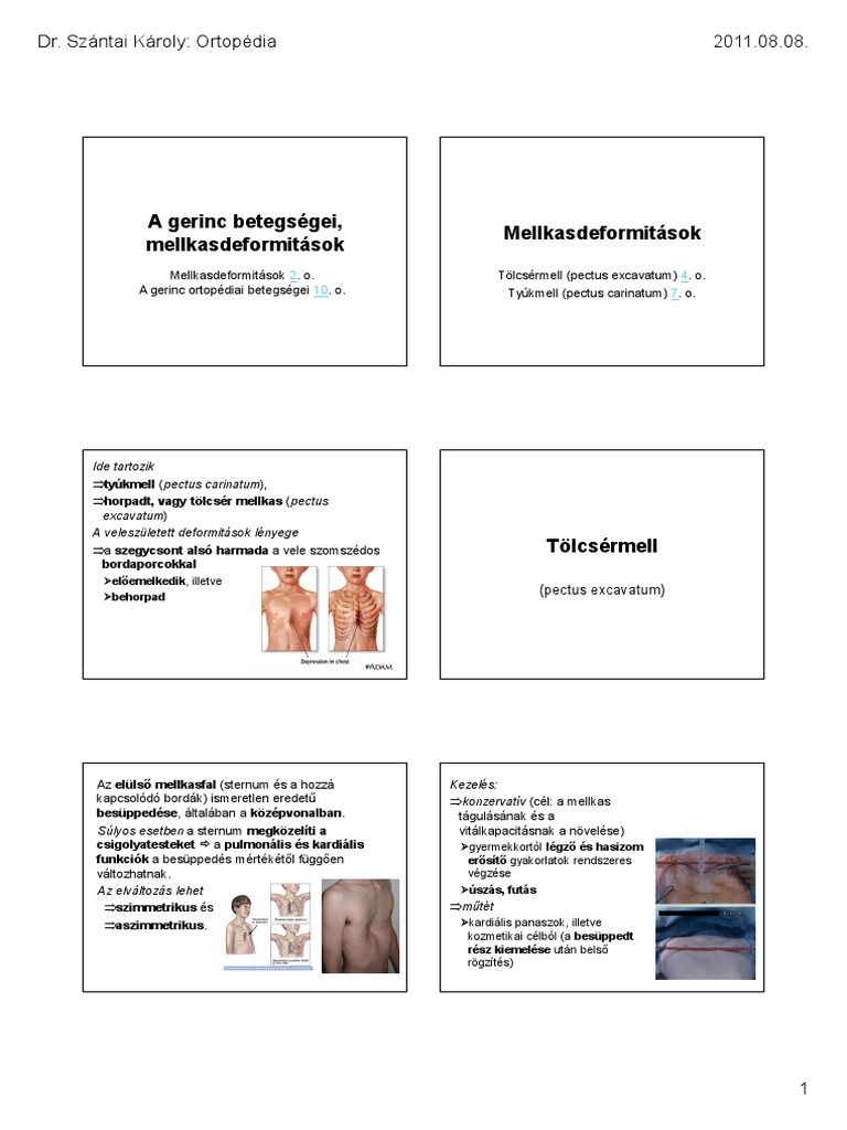 A Gerinc Ortopédiai Betegségei És A Mellkasdeformitások | PDF