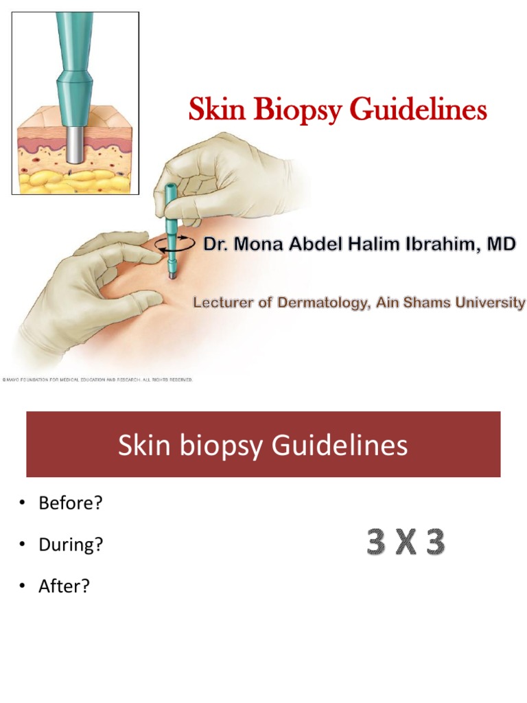Skin Biopsy Guidelines | PDF | Biopsy | Surgical Suture