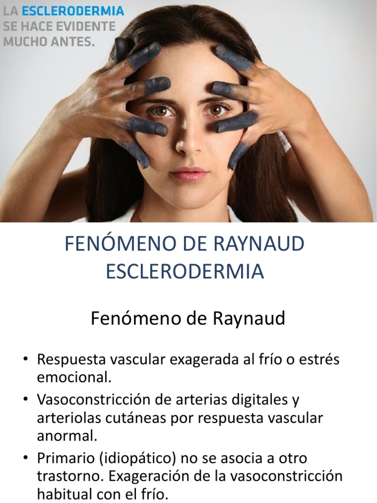 Esclerodermia y Fenómeno de Raynaud | PDF | Causas de la muerte | Medicina