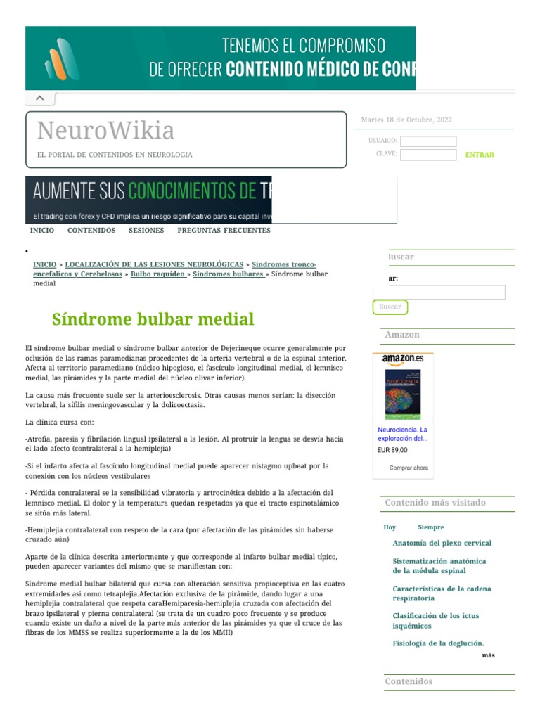 Síndrome Bulbar Medial: Causas y Clínica | PDF | Cerebro | Medicina CLINICA