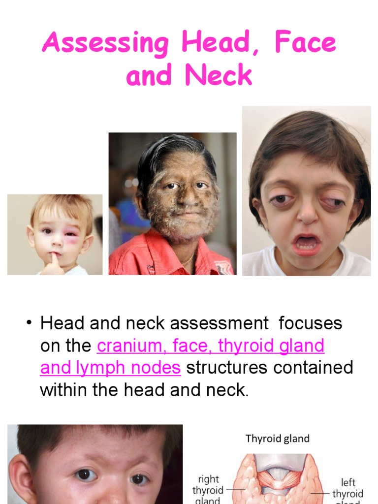 Assessing Head, Face and Neck | PDF | Skull | Human Nose