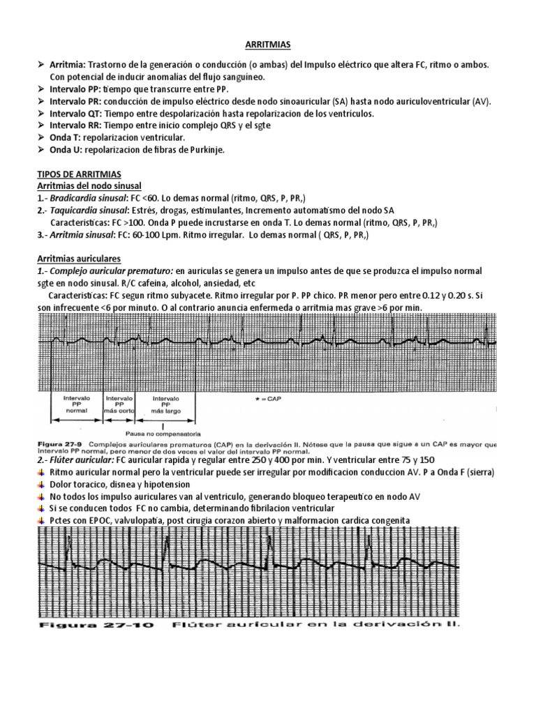 Arritmias Resumen | PDF | Electrocardiografia | Arritmia cardiaca