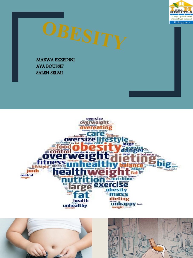 Obesity | PDF | Obesity | Sedentary Lifestyle