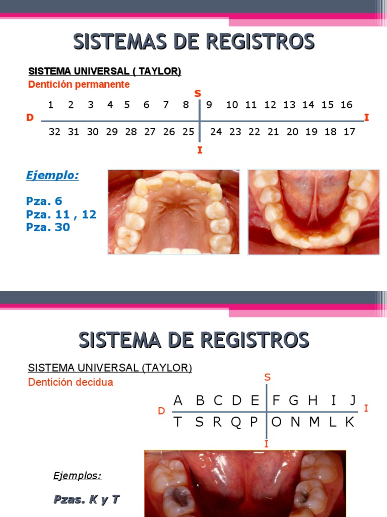 Odontograma: Sistema Universal y FDI | PDF | Odontología | Diente