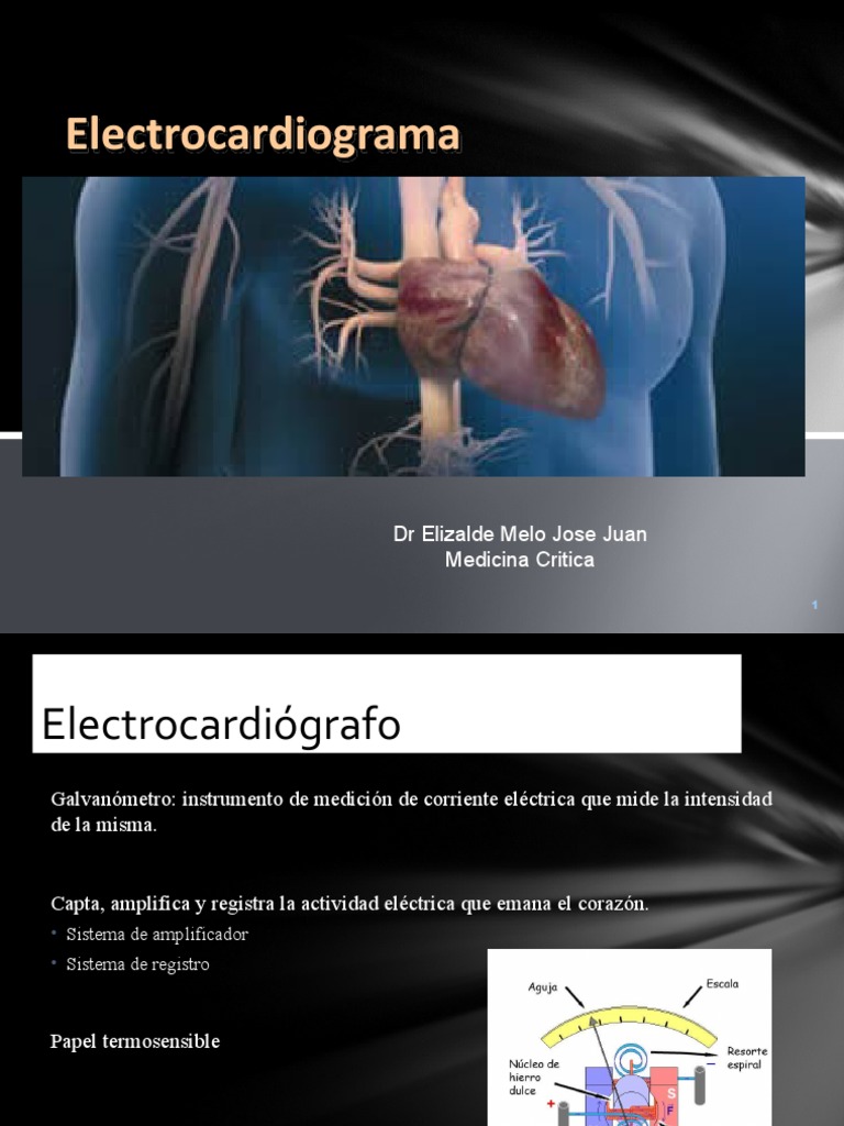 Electro 1 | PDF | Electrocardiografia | Arritmia cardiaca